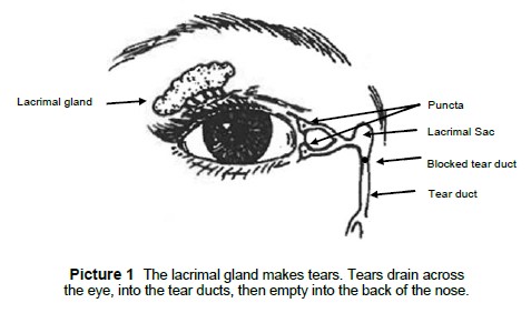 Blocked Tear Duct Upper Eyelid