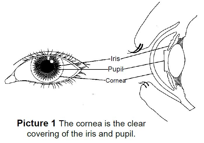 Eye Injury (Corneal Abrasion): Symptoms, Diagnosis and Treatment