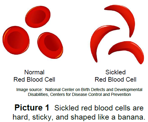 Children With Sickle Cell Anemia