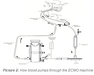 Ecmo Parts