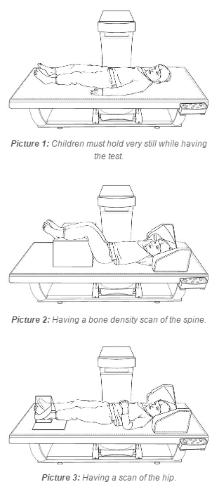 Good Spine Bone Density Test